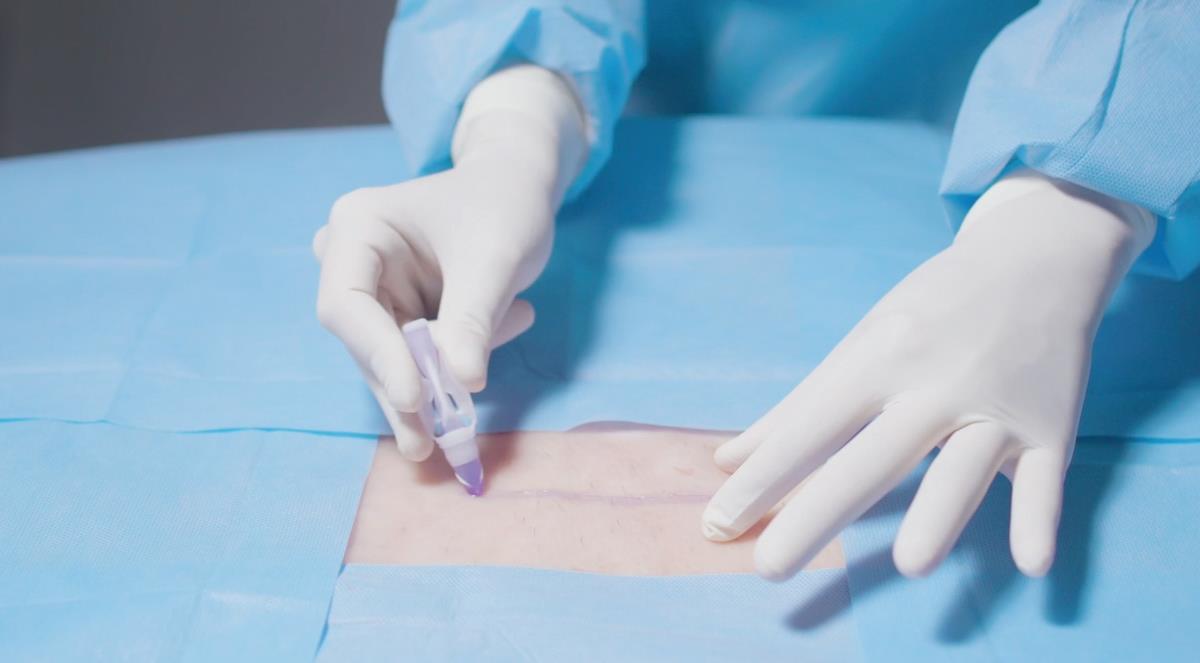 OptiClose Rapid Topical Skin Adhesive | Medline