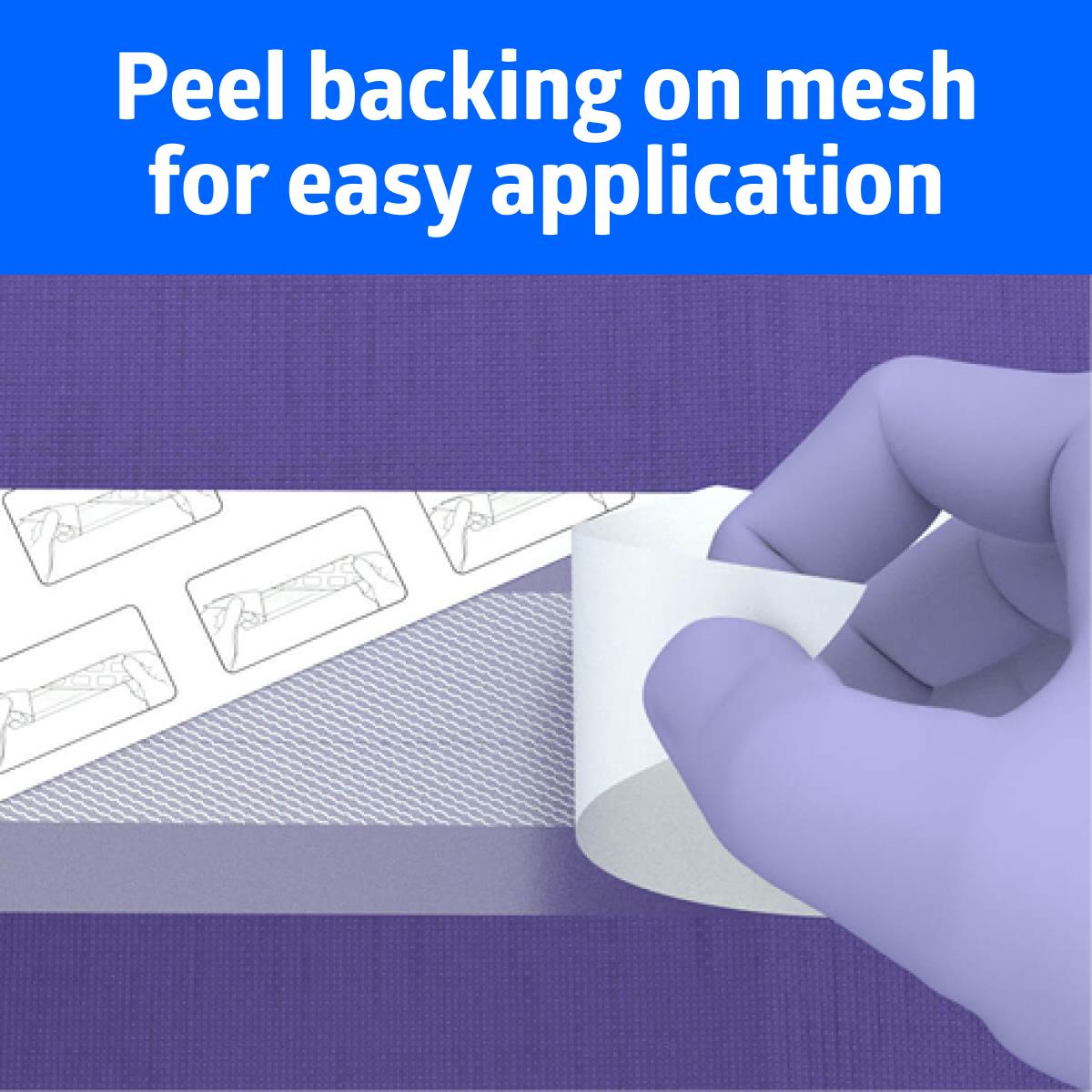 OptiClose Secure Wound Closure Device | Medline