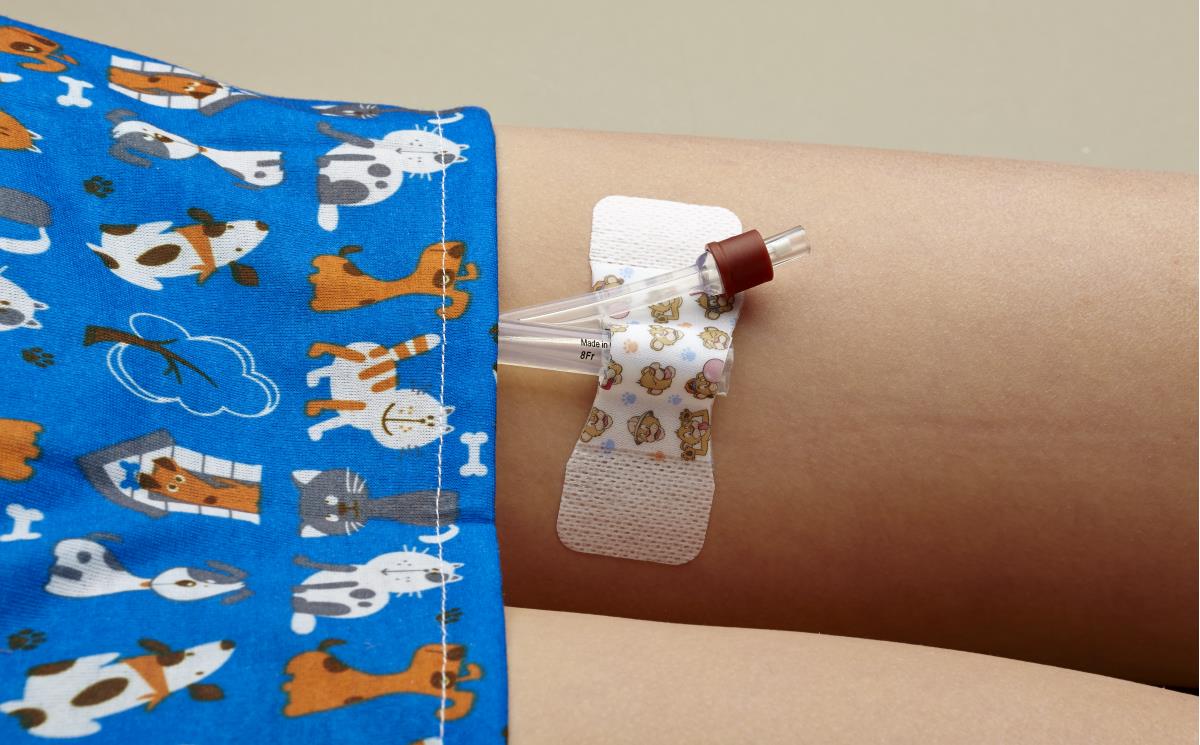 Centurion Pediatric Foley Anchor Securement Device | Medline