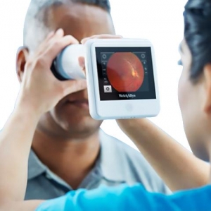 RetinaVue 100 Diabetic Retinopathy Screening Imager Accessories ...