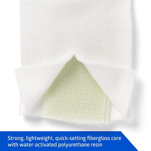 Medline Single-Sided Fiberglass Precut Splints | Medline