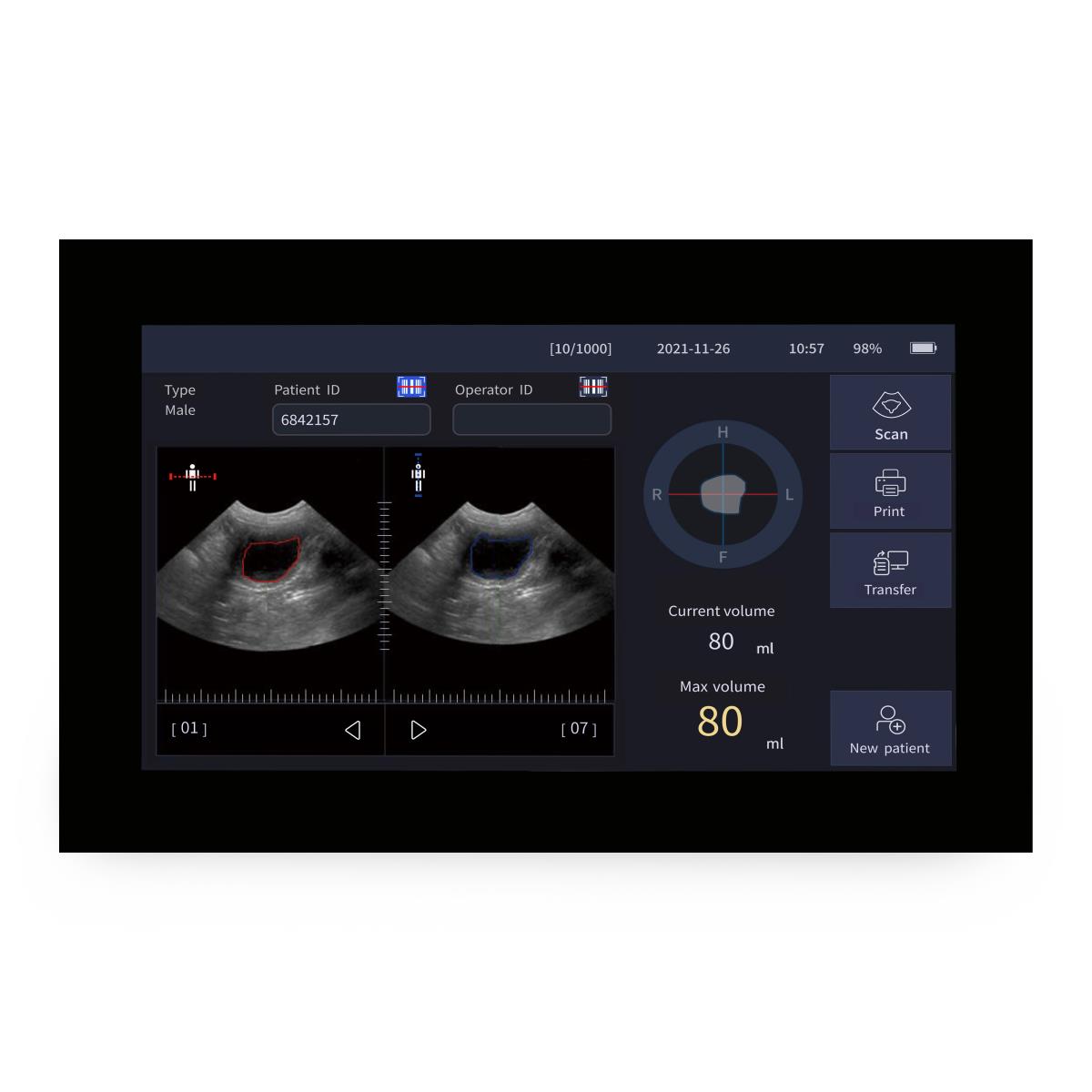 BioCon 1100 Ultrasound Bladder Scanner with Printer | Medline