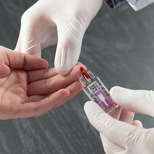 Now Diagnostics ADEXUSDx hCG Test | Medline Industries, Inc.