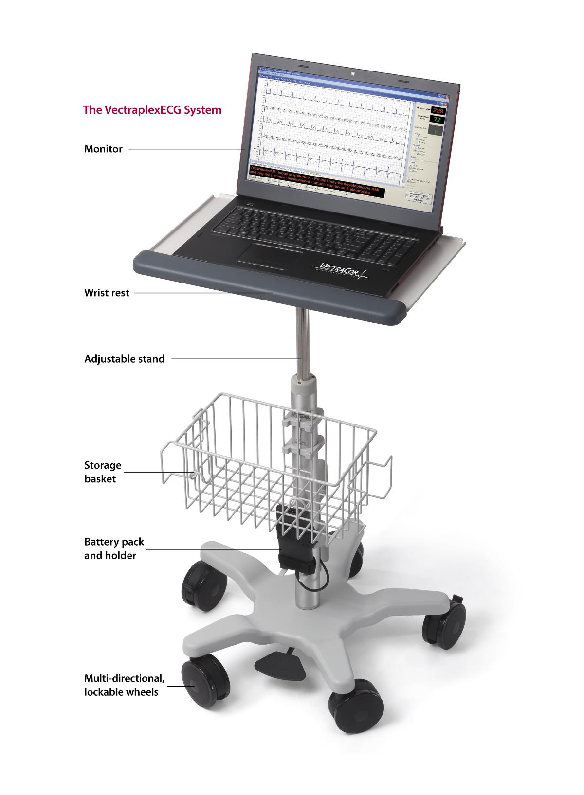 VectraplexECG System | Medline