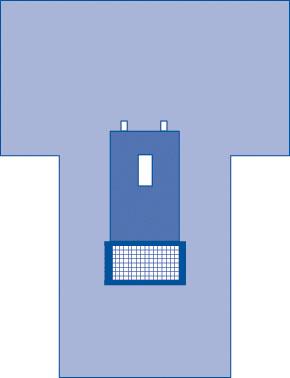 Sterile Cystoscopy Surgical Pack VI | Medline