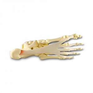 3B Scientific Foot / Ankle Plantar Fasciitis Model | Medline Industries ...