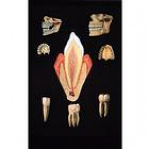 Healthy Denture Chart (Alt) by American 3B Scientific | Medline ...