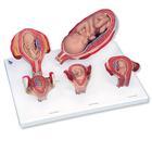 Pregnancy Series - 5 Models | Medline