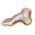 Hollow Foot Pes Cavus Model For Educational Use Medline 4998