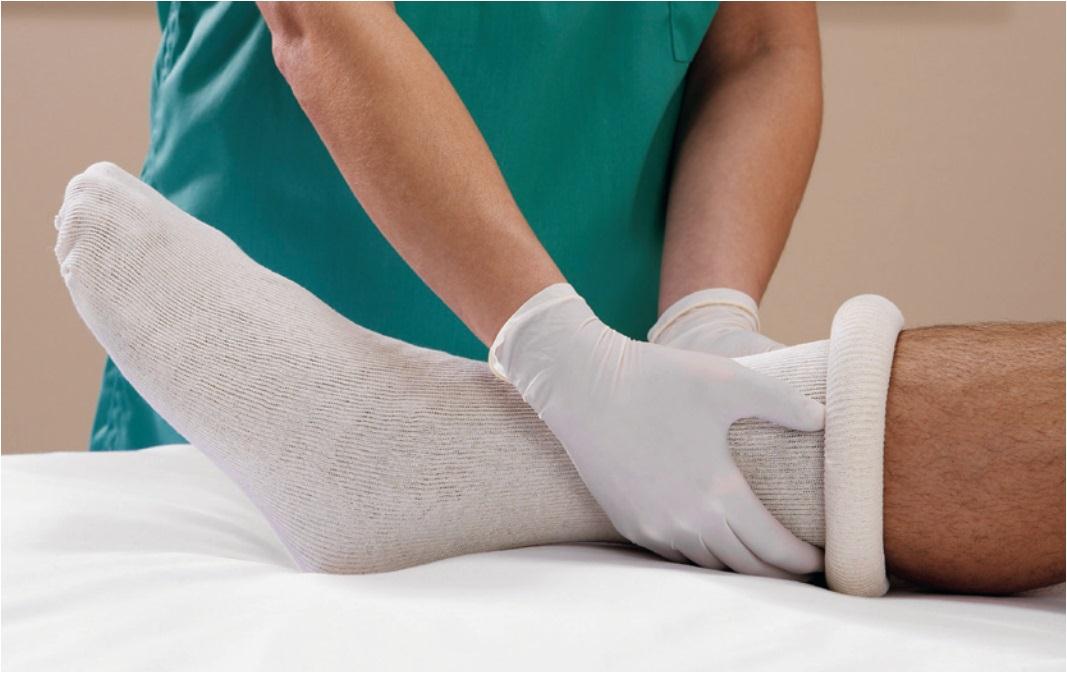 Sterile Double-Ply Tubular Synthetic Stockinettes | Medline