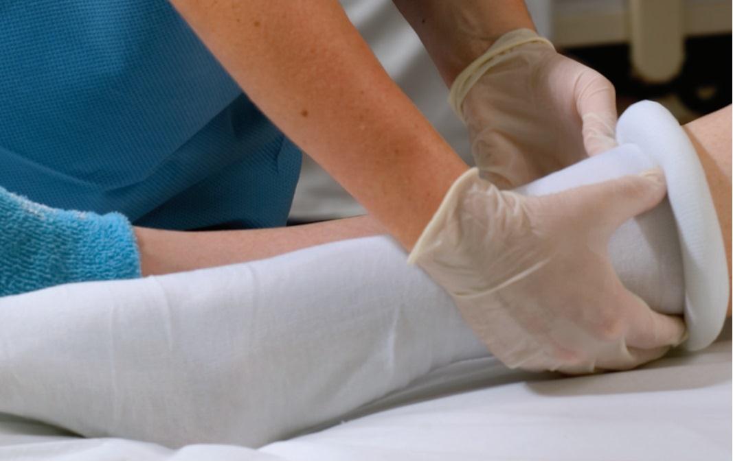 UltraCARE Thigh-Length Antiembolism Stocking | Medline