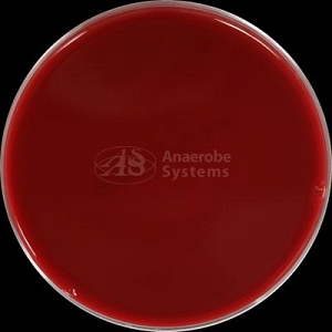 Anaerobe Systems Brucella Blood Agar Plate | Medline Industries, Inc.