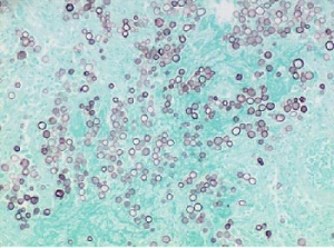 GMS Stain Kit (Modified Gomori) | Medline Industries, Inc.