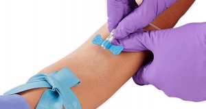 BD Vacutainer Pushbutton Blood Collection Set with Luer Adapter ...