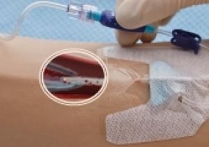 Nexiva Diffusics Catheters by BD | Medline Industries, Inc.
