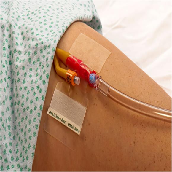 Dale Hold-n-Place Foley Catheter Holders | Medline