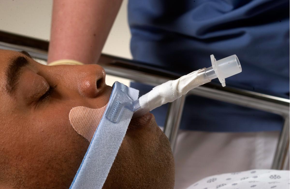 Stabilock Endotracheal Tube Holders | Medline