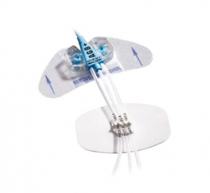 StatLock CV Plus Stabilization Device | Medline Industries, Inc.