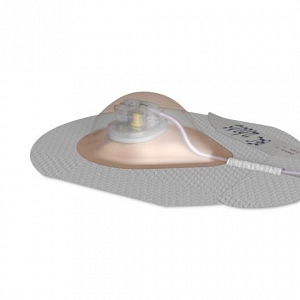 Sentrinex 3D Port Dressings | Medline Industries, Inc.