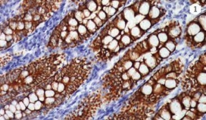 Canine Micro-polymer Detection Kit | Medline Industries, Inc.