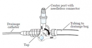 I.C. Medical Port Drainage Catheters | Medline