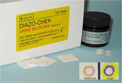 DIAZO-CHEK Bilirubin Urine Test Kits | Medline