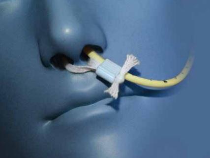 Corgrip Nasogastric/Nasointestinal Tube | Medline