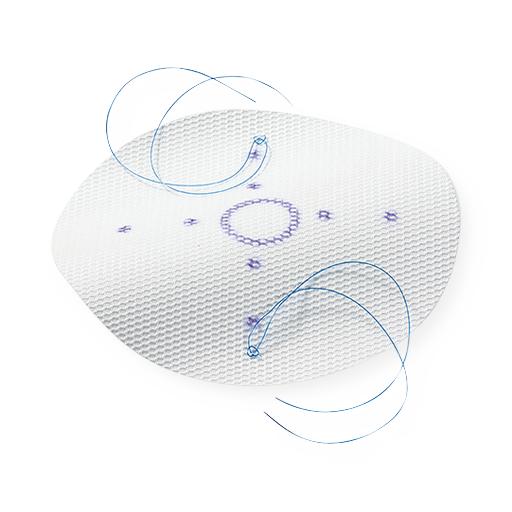 Medtronic Parietene DS Composite Meshes | Medline