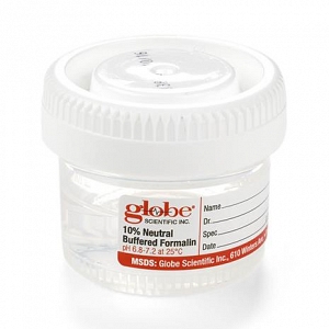 Formalin Filled Tite-Rite Containers by Globe Scientific | Medline Industries, Inc.