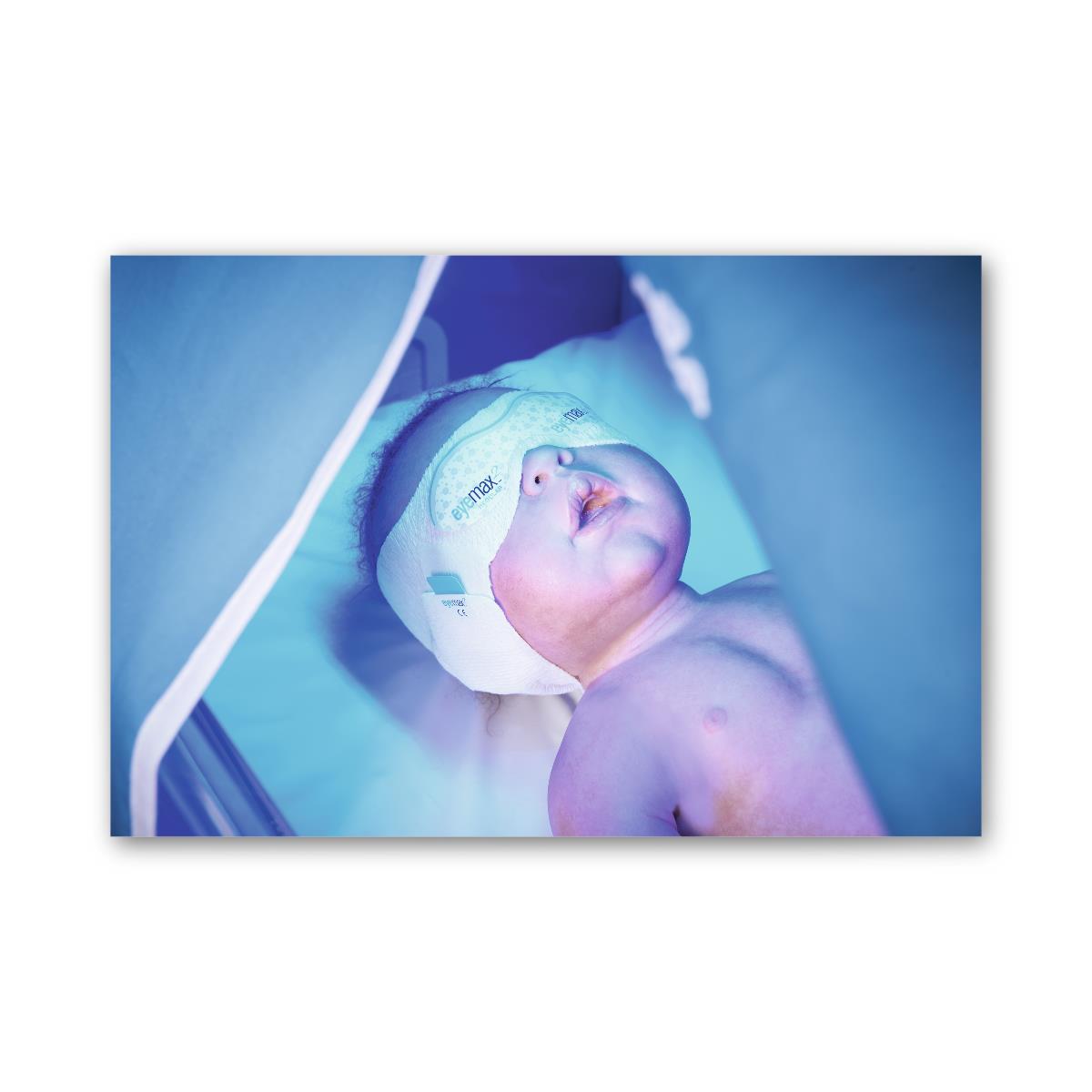 EyeMax 2 Phototherapy Masks | Medline