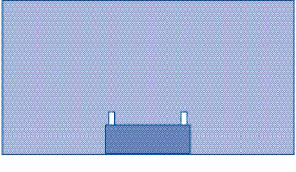 Sterile Universal Split Surgical Pack II | Medline