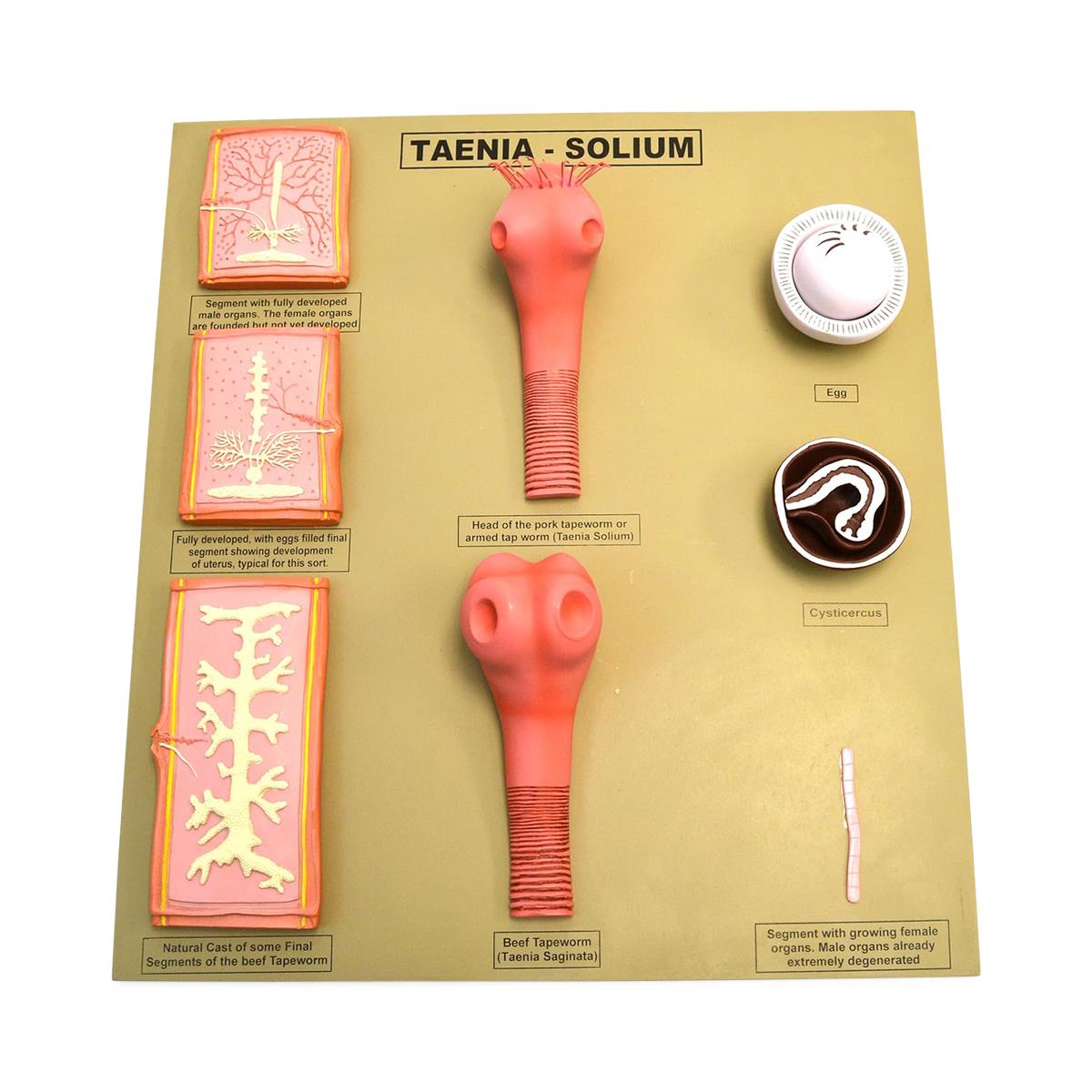 Tapeworm Model | Medline