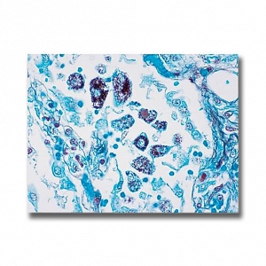 Epredia Modified Grocott's Methenamine Silver Stain Kit | Medline ...