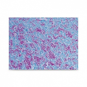 Acid-Fast Bacillus Stain Kits | Medline Industries, Inc.