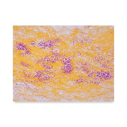 Gram Tissue Stain Solution Kit | Medline