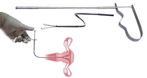 Serpentine Grasper I. U.D. Removers | Medline Industries, Inc.