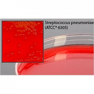 BHI Agar with Blood | Medline Industries, Inc.