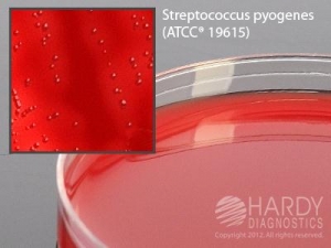 Selective Beta Strep Agar by Hardy Diagnostics | Medline Industries, Inc.