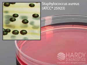 Vogel and Johnson Agar by Hardy Diagnostics | Medline Industries, Inc.