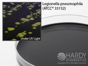 BCYE Agar with GVPC Antibiotics | Medline Industries, Inc.