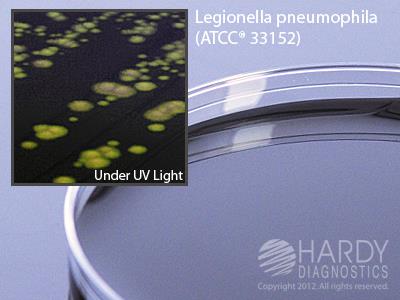 BCYE Agar for Legionella | Medline