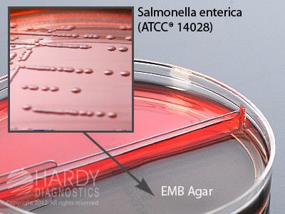 Blood Agar 5%/EMB (Eosin Methylene Blue) | Medline