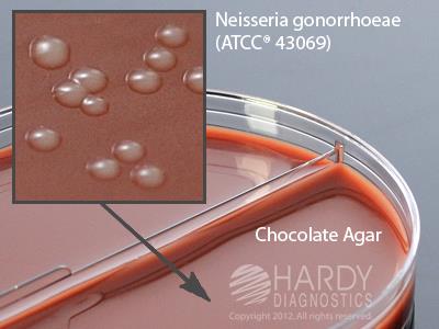 Hardy Diagnostics Chocolate/Modified Thayer Martin Biplate | Medline