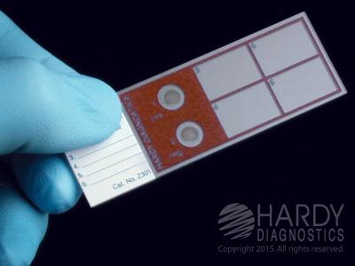 Q-Slide Acid Fast Control Slide | Medline
