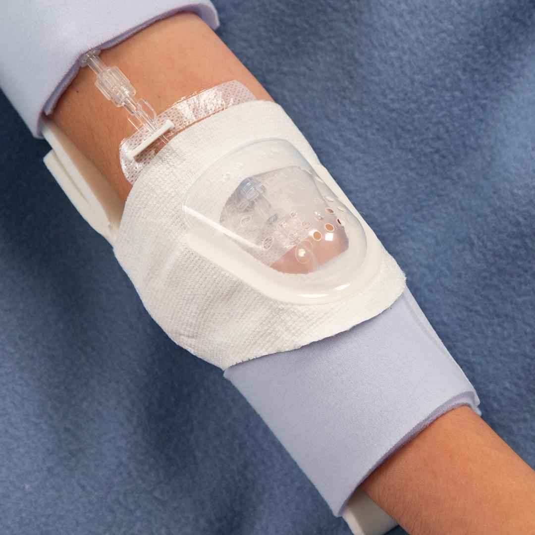 TLC Elbow Splints | Medline