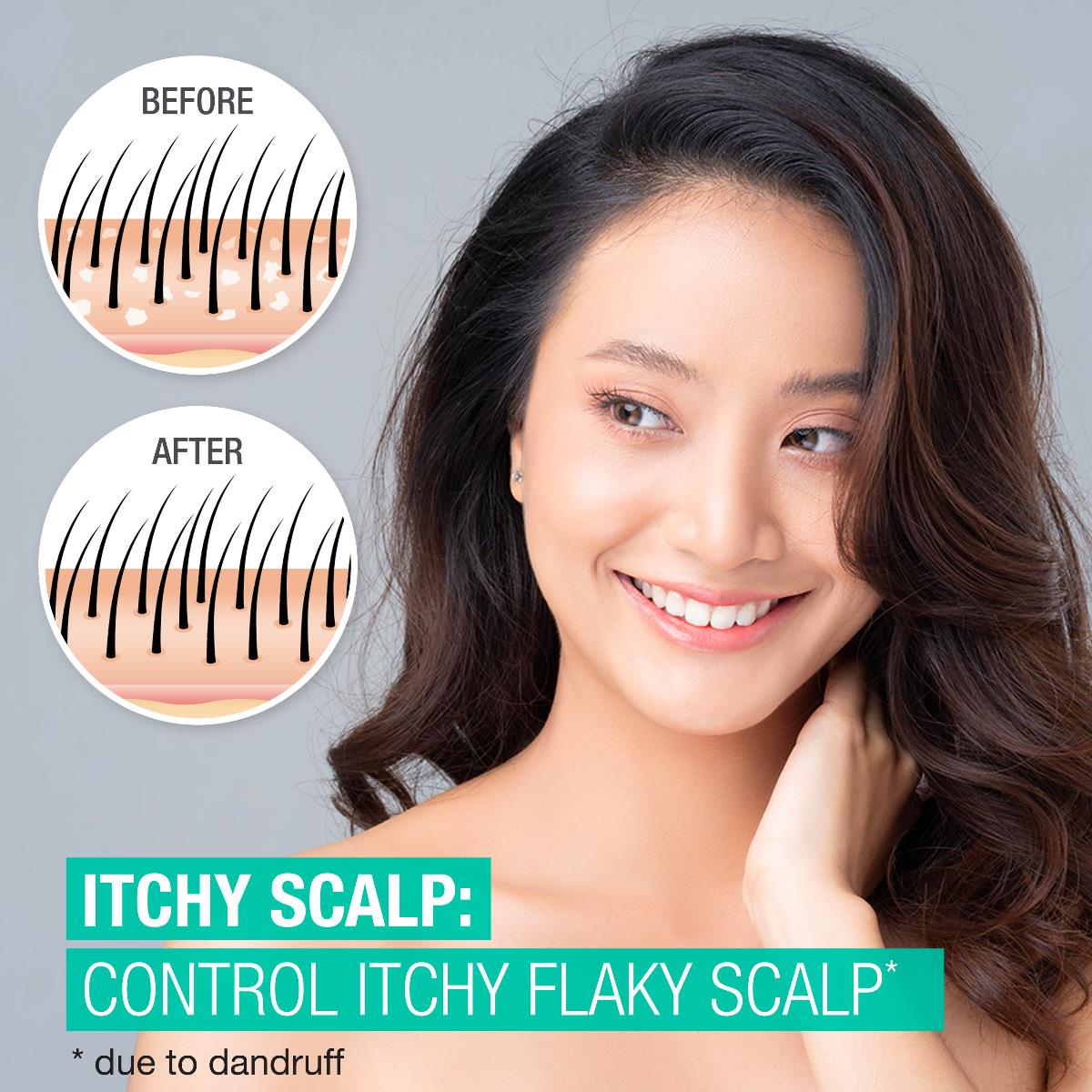 Scalp Therapy Anti-Dandruff Shampoo | Medline