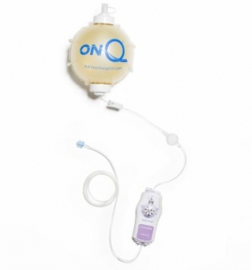 On-Q Pump with Select-A-Flow | Medline Industries, Inc.