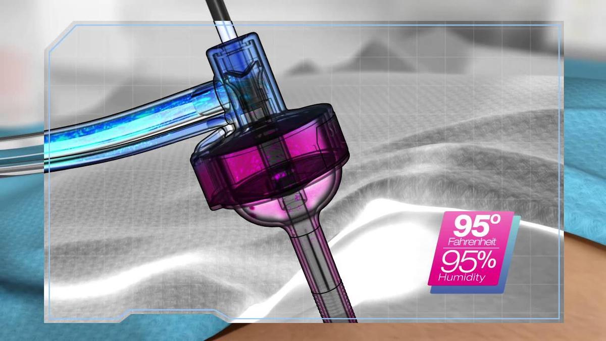 Insuflow Laparoscopic Gas Conditioning Systems | Medline
