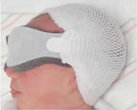 Bili-Bonnet Phototherapy Masks | Medline