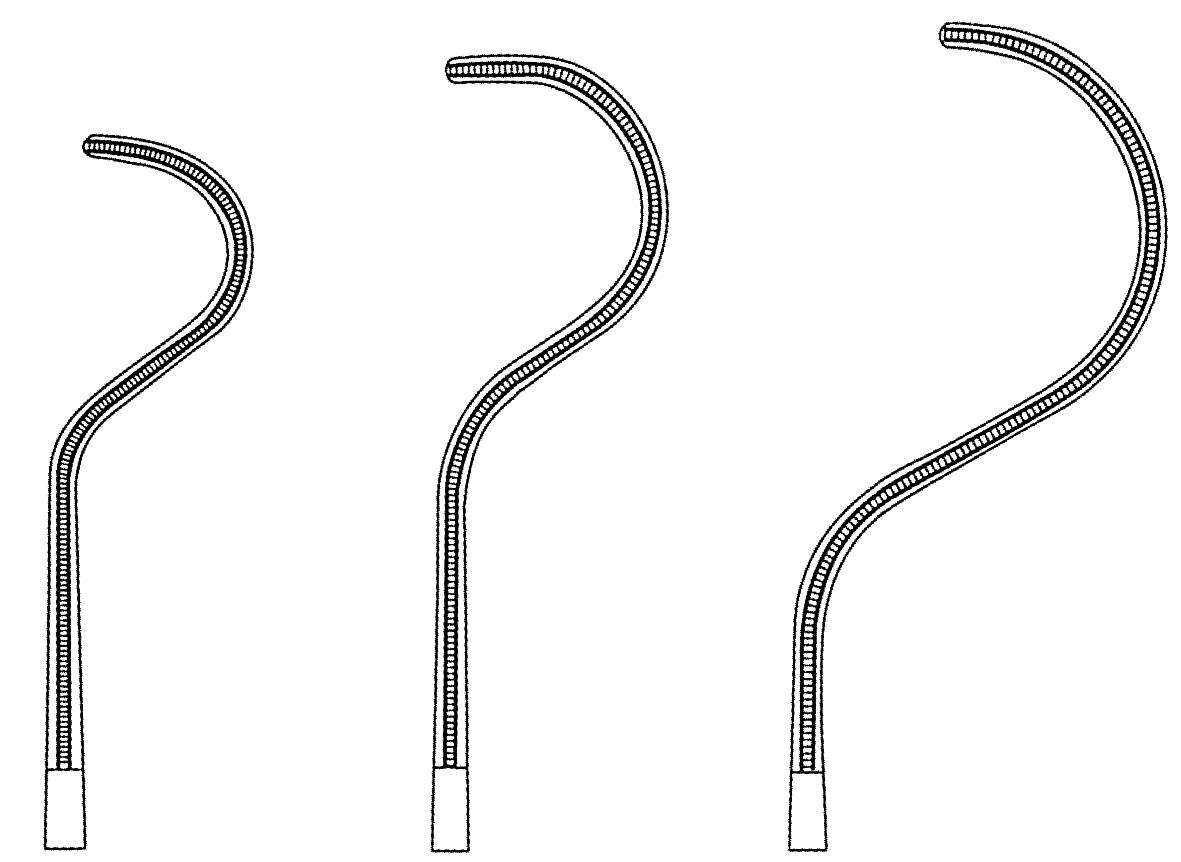 König Dale Femoral-Popliteal Clamps | Medline